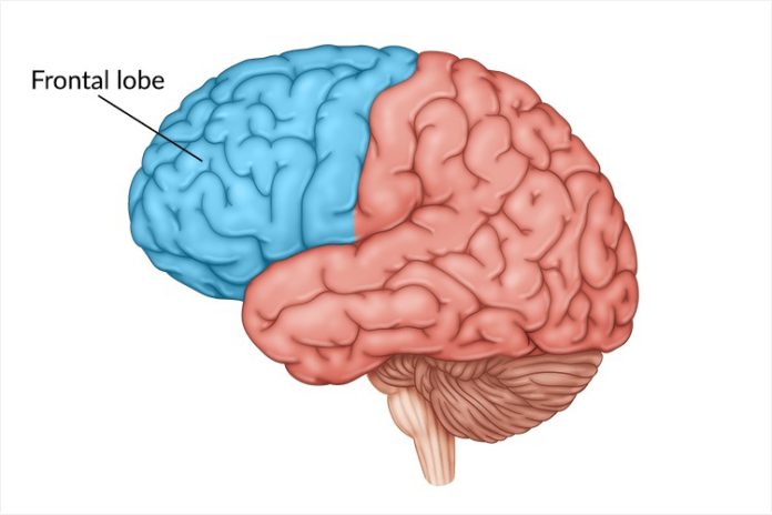 Causes of Damage to the Right Posterior Frontal Lobe - EsHealthTips Causes of Damage to the Right Posterior Frontal Lobe - EsHealthTips