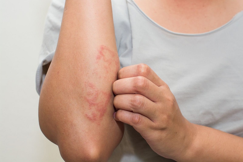 Understanding Skin Disease Symptoms - EsHealthTips