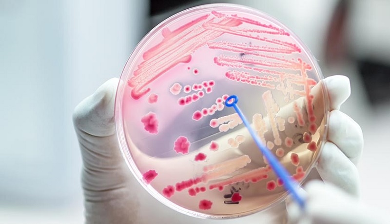 Factors That Cause Coccoid Bacteria - EsHealthTips